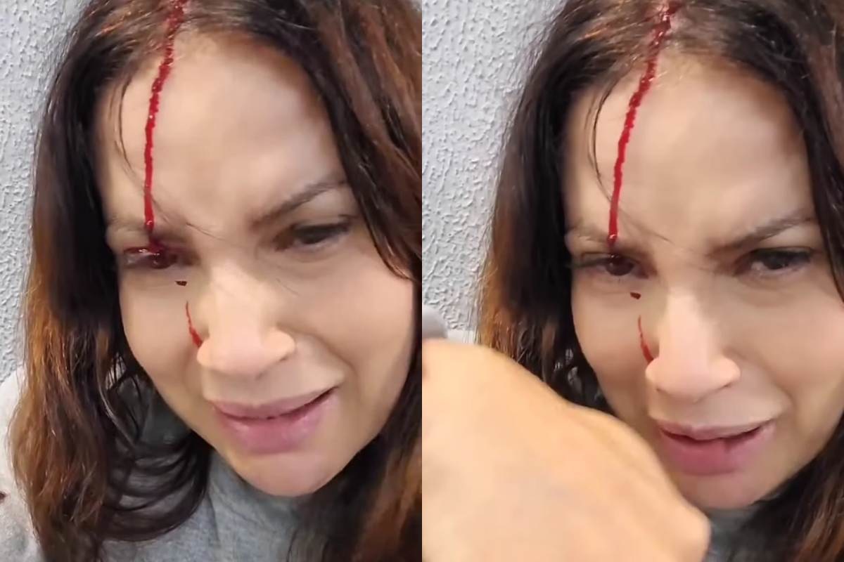 Musa de Tieta, Isadora Ribeiro sofre corte na cabeça ao ser atingida ...